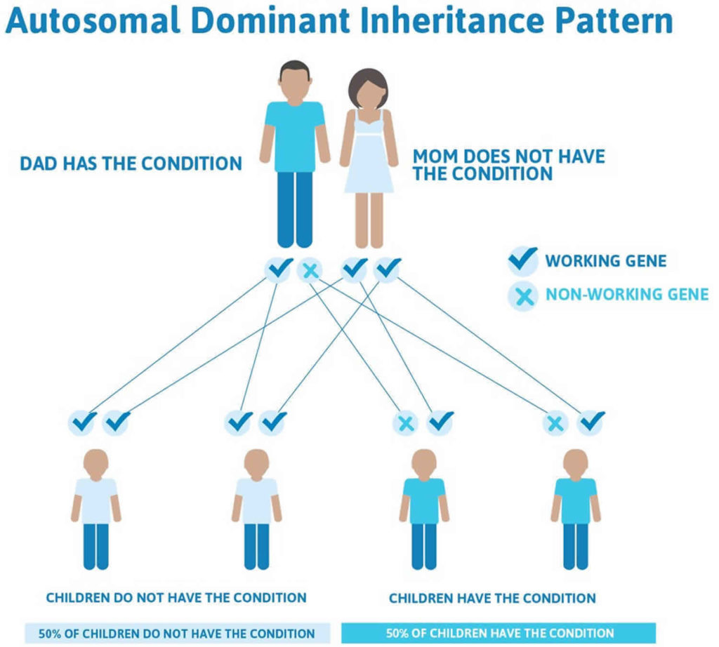 PTEN hamartoma tumor syndrome causes, symptoms, diagnosis & treatment